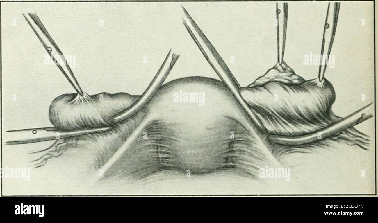 . A manual of gynæcology and pelvic surgery, for students and ...
