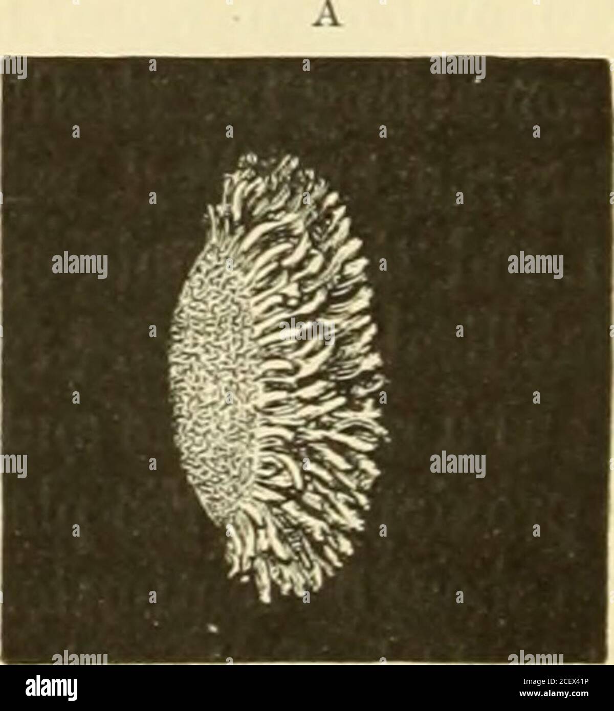 Full term fetus hi-res stock photography and images - Alamy