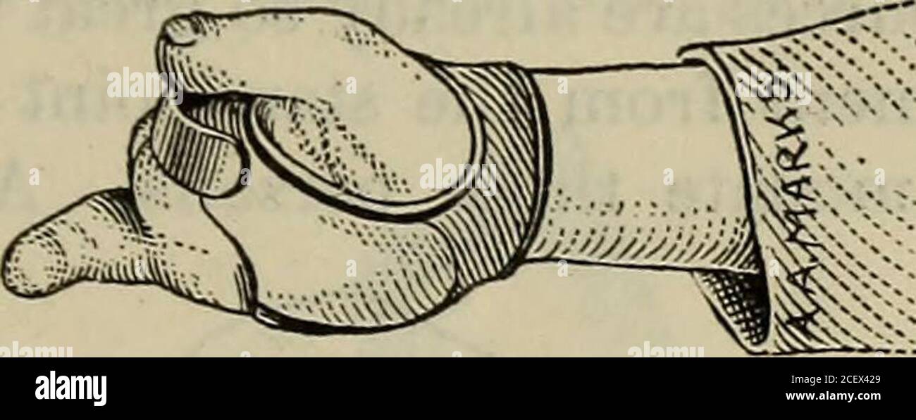 Mutilated hand hi-res stock photography and images - Alamy