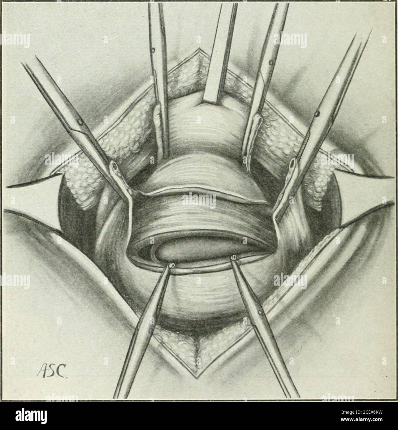 . A manual of gynæcology and pelvic surgery, for students and ...