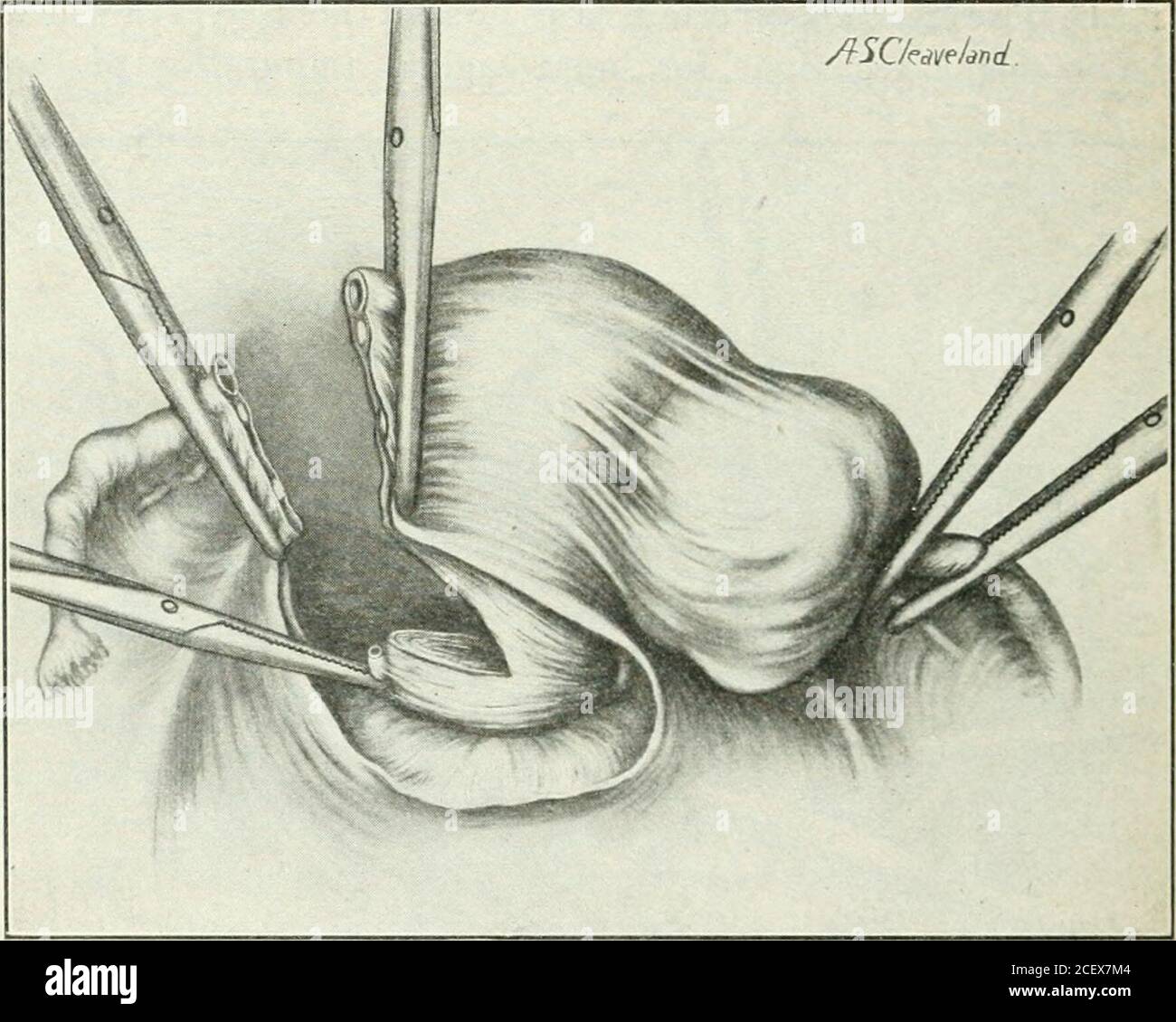 . A manual of gynæcology and pelvic surgery, for students and ...