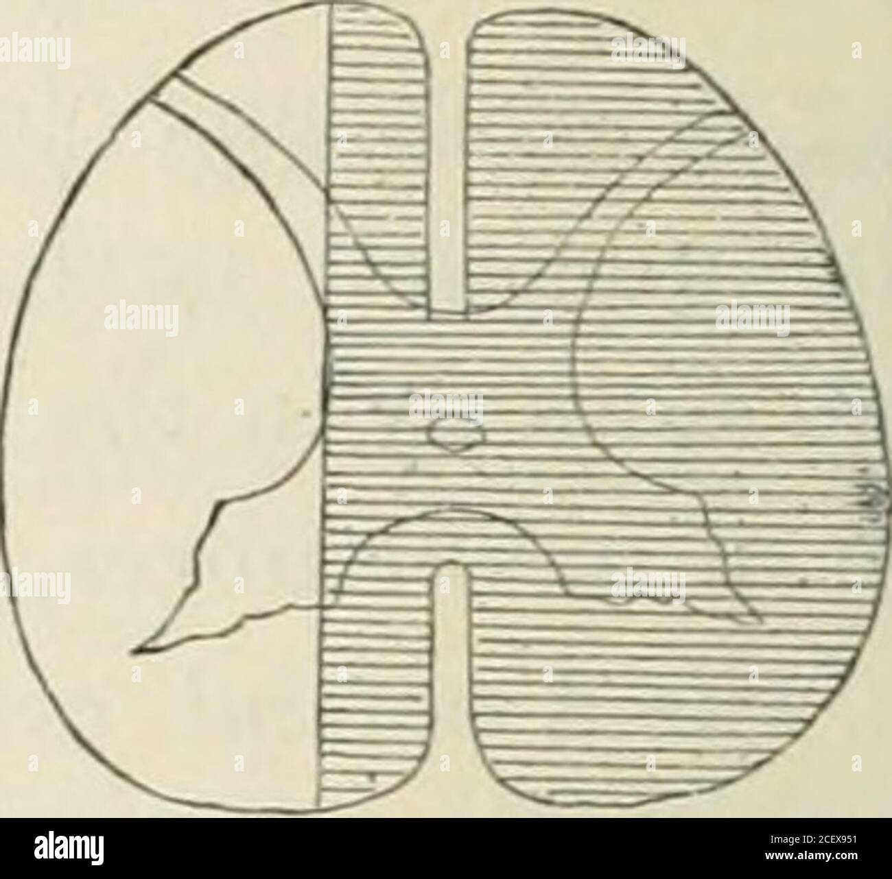 Second cervical vertebra hi-res stock photography and images - Alamy