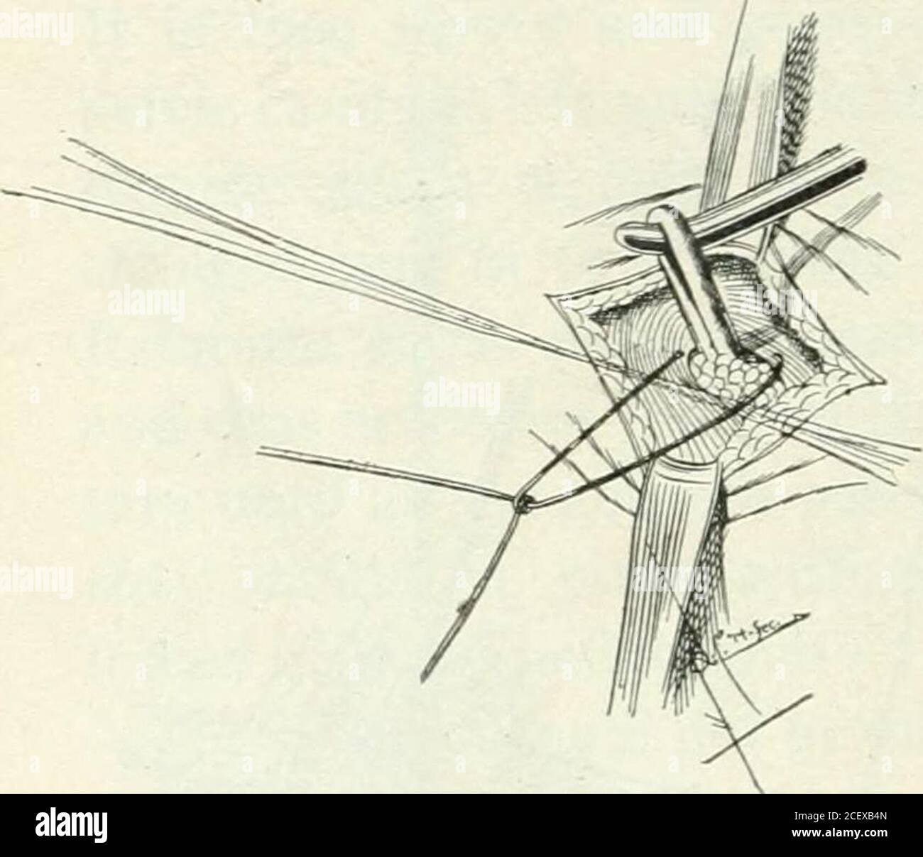 . A manual of gynæcology and pelvic surgery, for students and ...