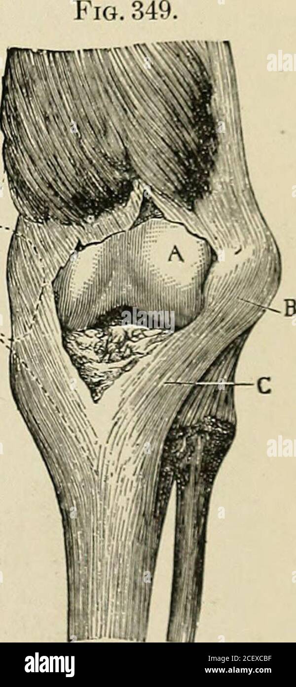 . A practical treatise on fractures and dislocations. r border of the ...
