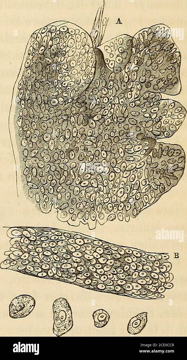Mammary tumors hi-res stock photography and images - Alamy