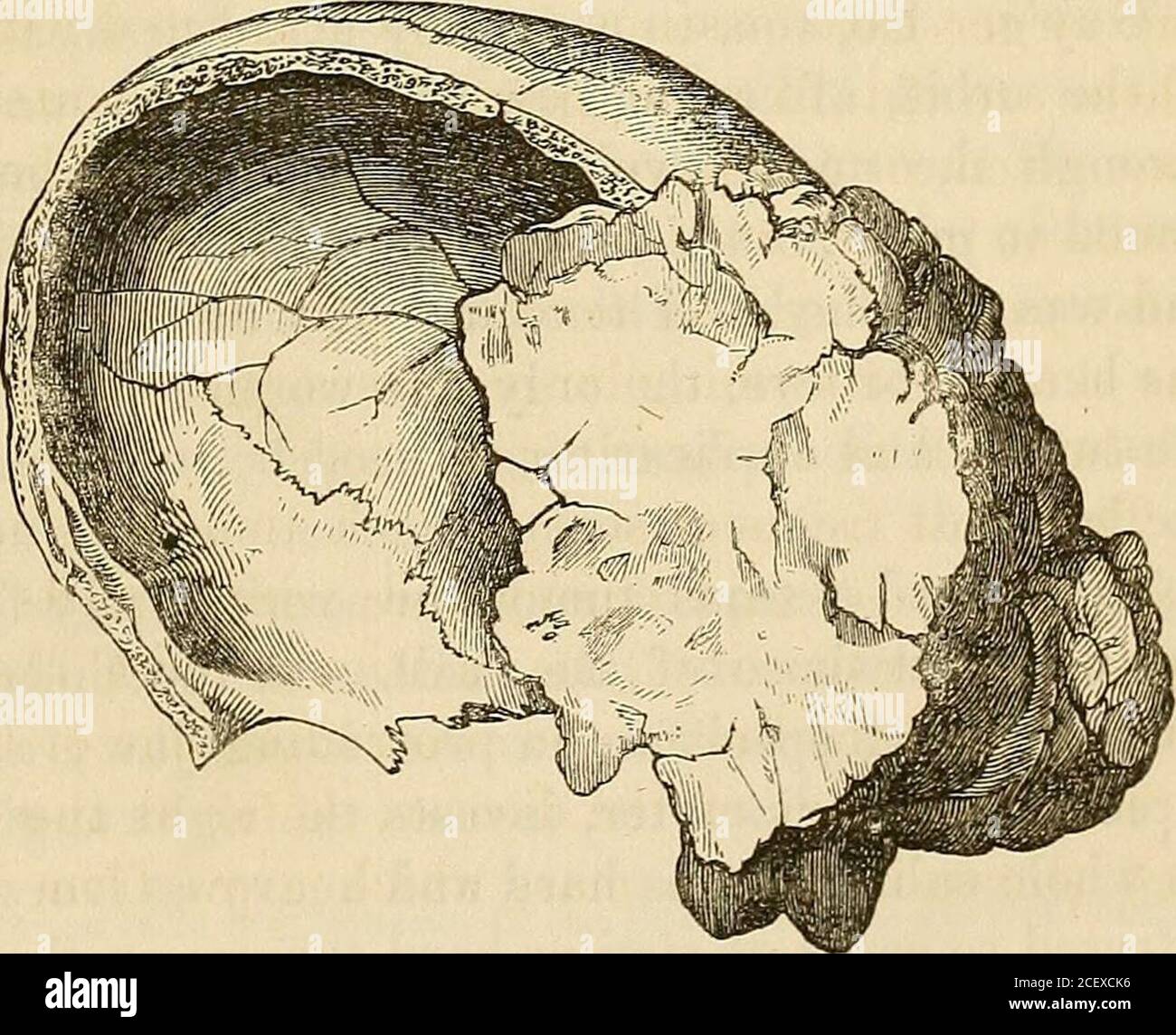 . Lectures on surgical pathology : delivered at the Royal College of ...