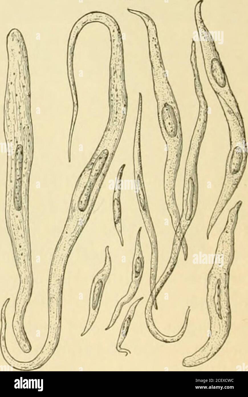 Muscularis mucosae hi-res stock photography and images - Alamy