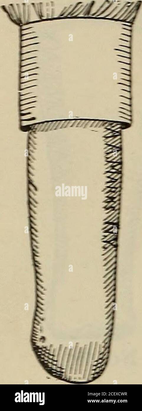 Styloid process of ulna hi-res stock photography and images - Alamy