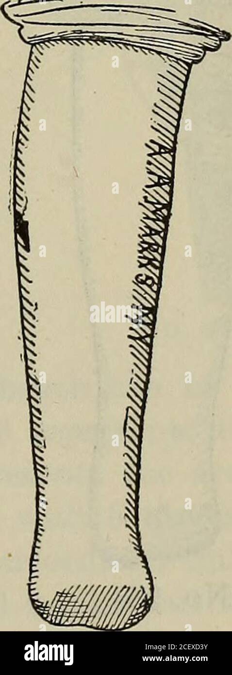 Styloid process of radius hi-res stock photography and images - Alamy