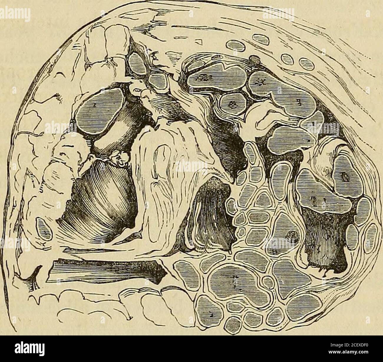. Lectures on surgical pathology : delivered at the Royal College of ...
