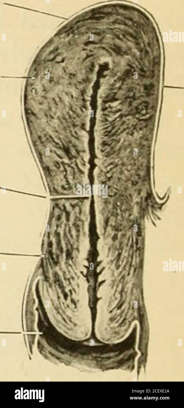 Internal Cervical Os Model Canal