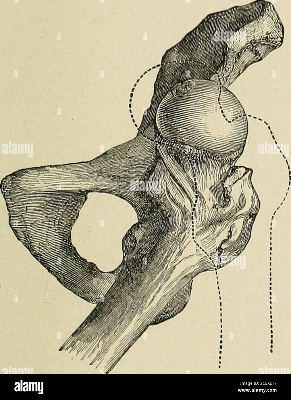 A Practical Treatise On Fractures And Dislocations Ences 1864 Vol Xxxviii P 272 2