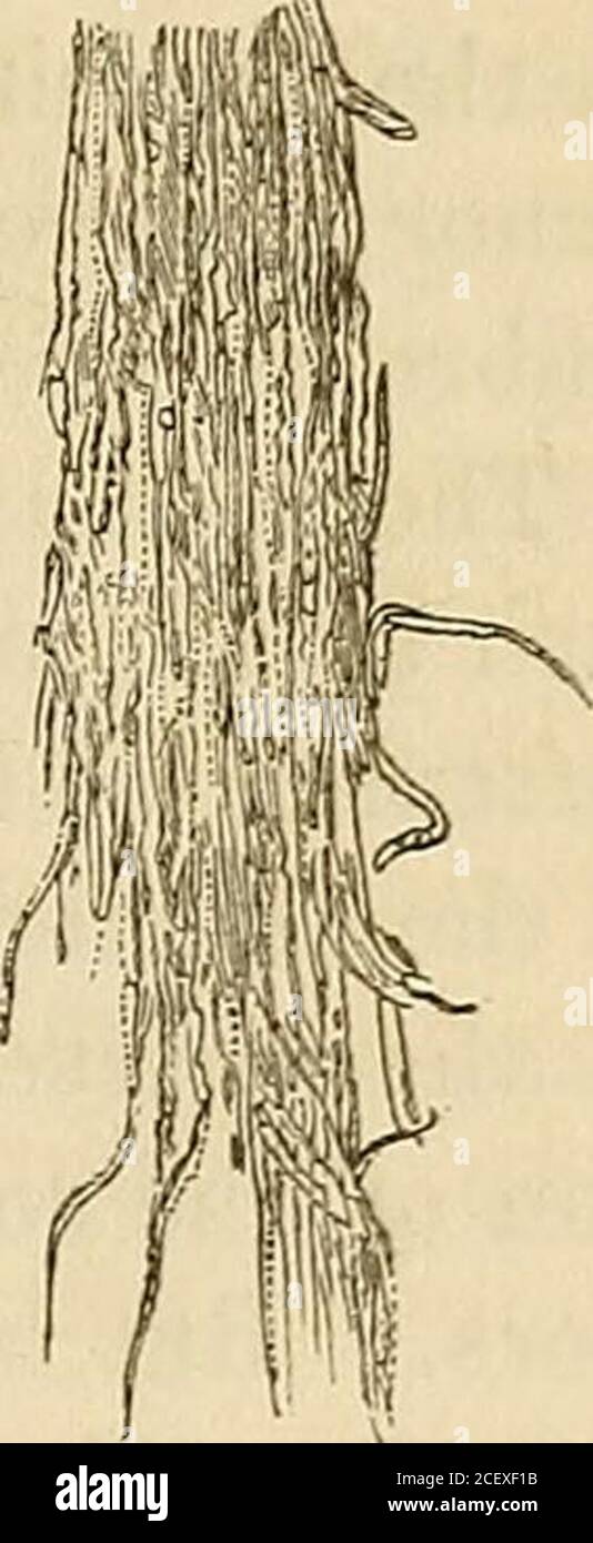 Fibrose hi-res stock photography and images - Alamy