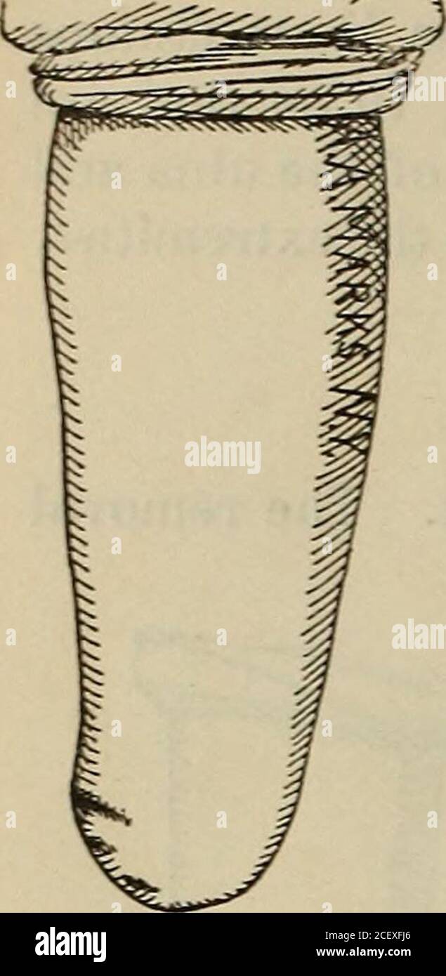 Styloid process of ulna hi-res stock photography and images - Alamy