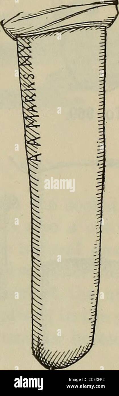 Styloid process of ulna hi-res stock photography and images - Alamy