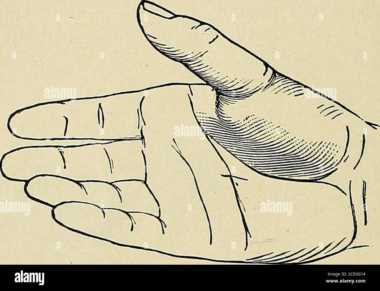 . A practical treatise on fractures and dislocations. -tinctly inferior ...