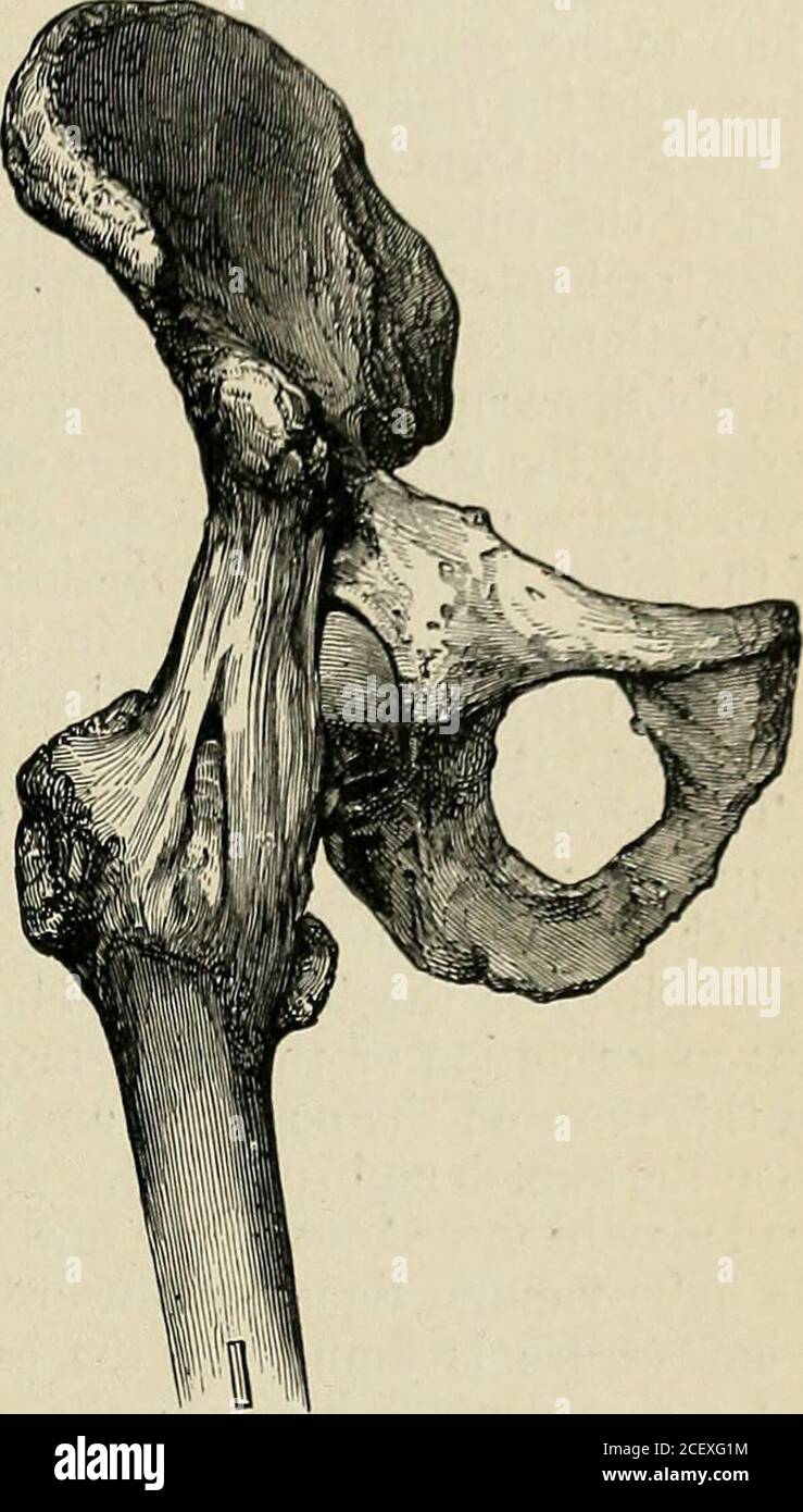 . A practical treatise on fractures and dislocations. femoral ligaments ...
