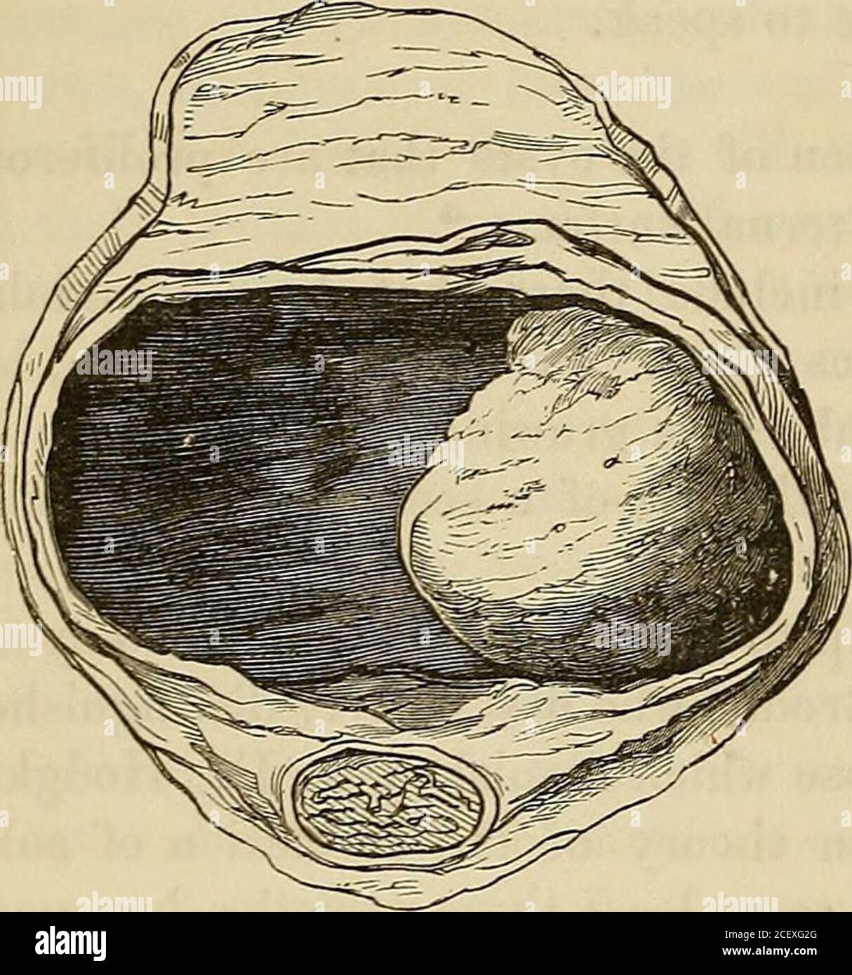 . Lectures on surgical pathology : delivered at the Royal College of ...