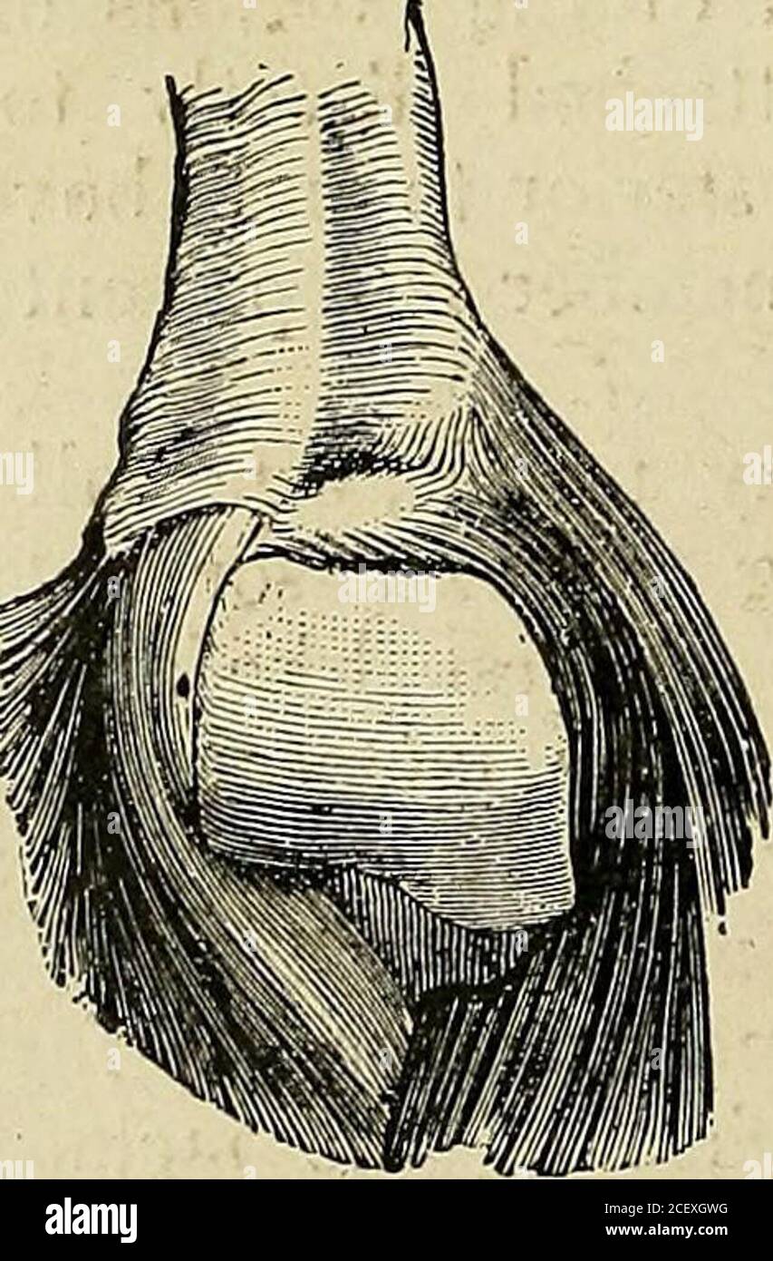 . A practical treatise on fractures and dislocations. Simple complete ...