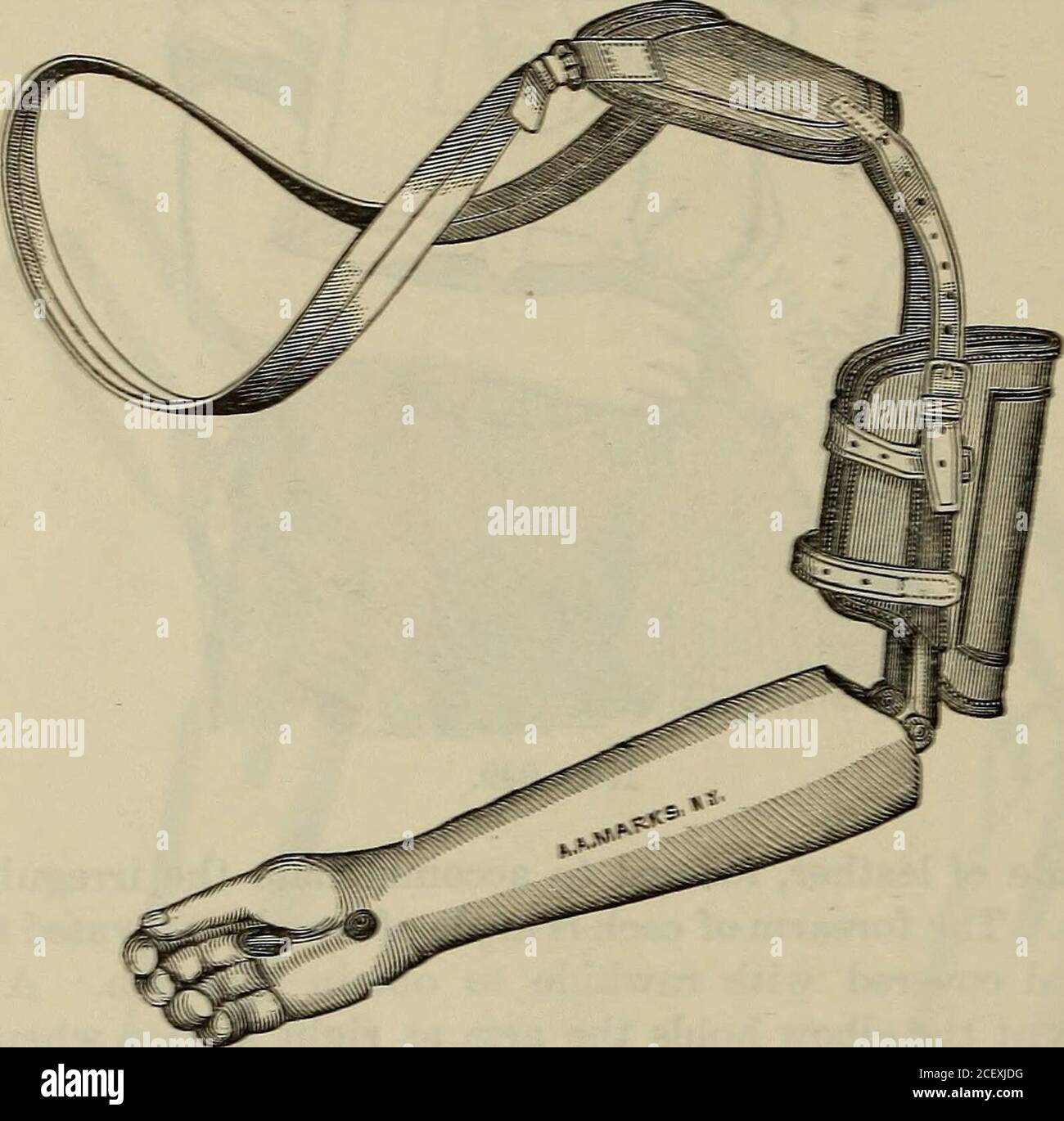 Below elbow amputation stump hi-res stock photography and images - Alamy