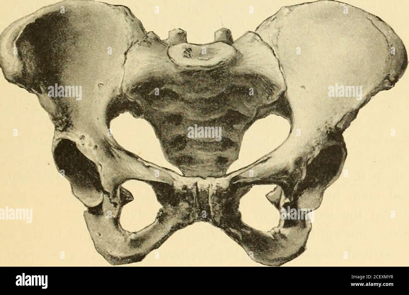 Symphysiotomy hi-res stock photography and images - Alamy