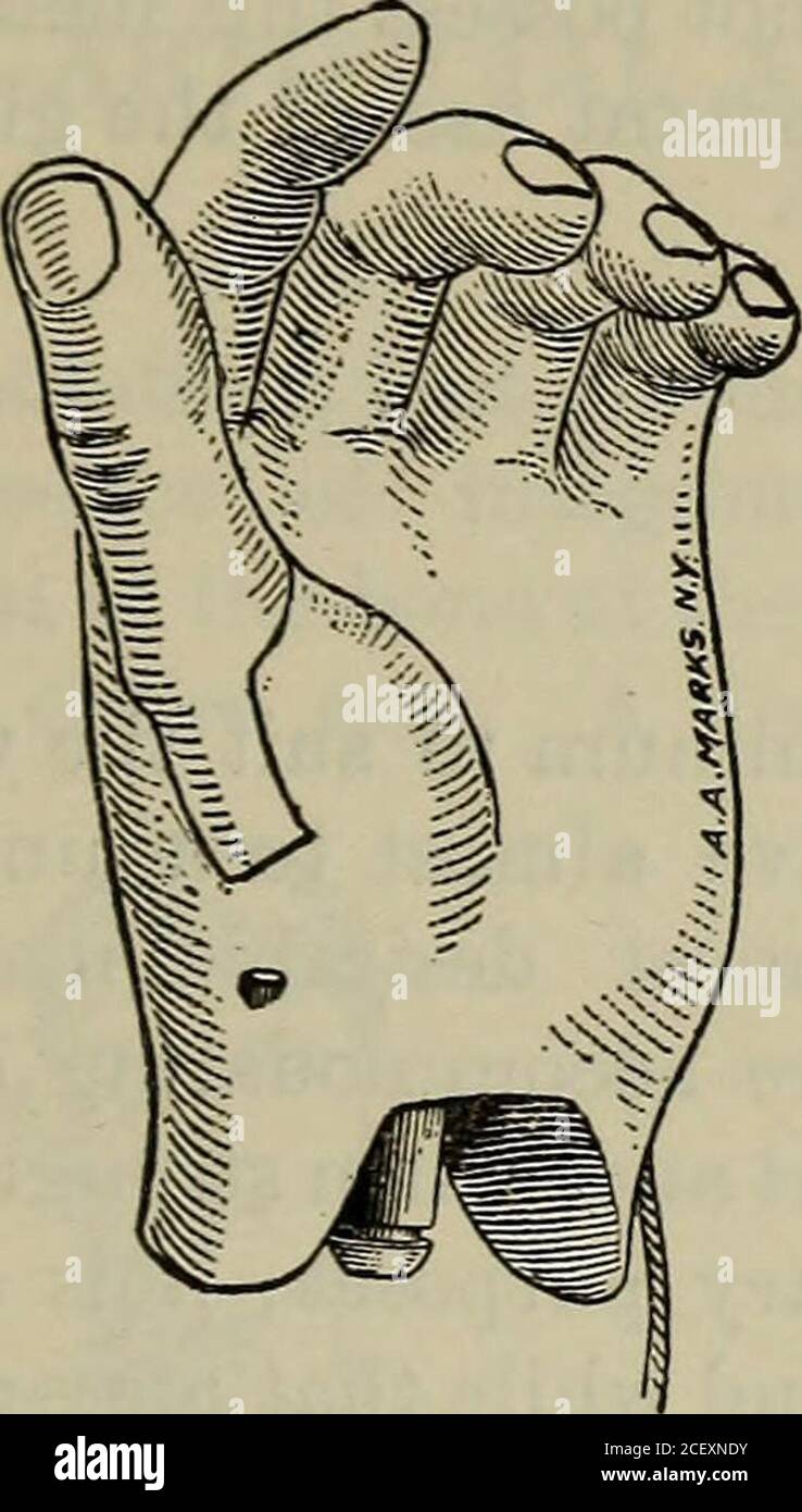 . A treatise on artificial limbs with rubber hands and feet ... No. 925 ...