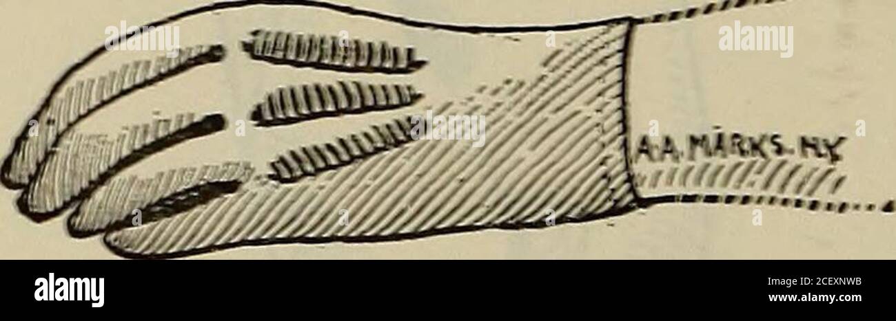 . A treatise on artificial limbs with rubber hands and feet ... Xo. 923 ...