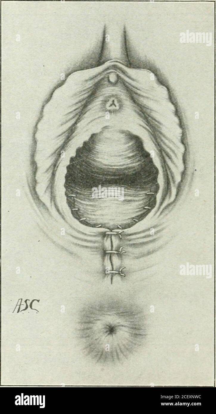 Stretchesout hi-res stock photography and images - Alamy