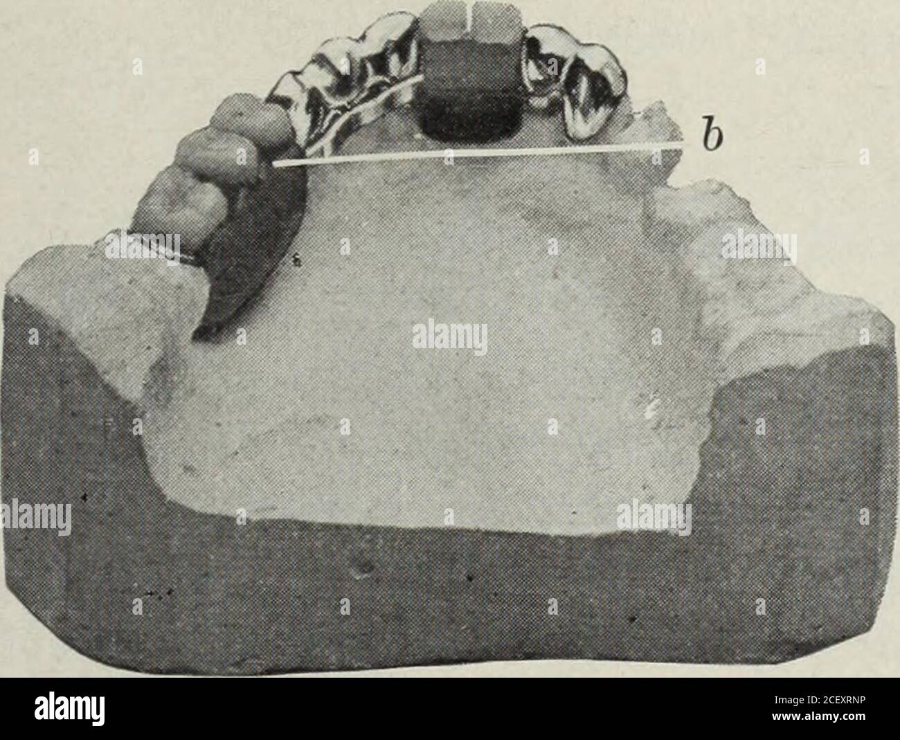 Imperfect teeth hi-res stock photography and images - Alamy