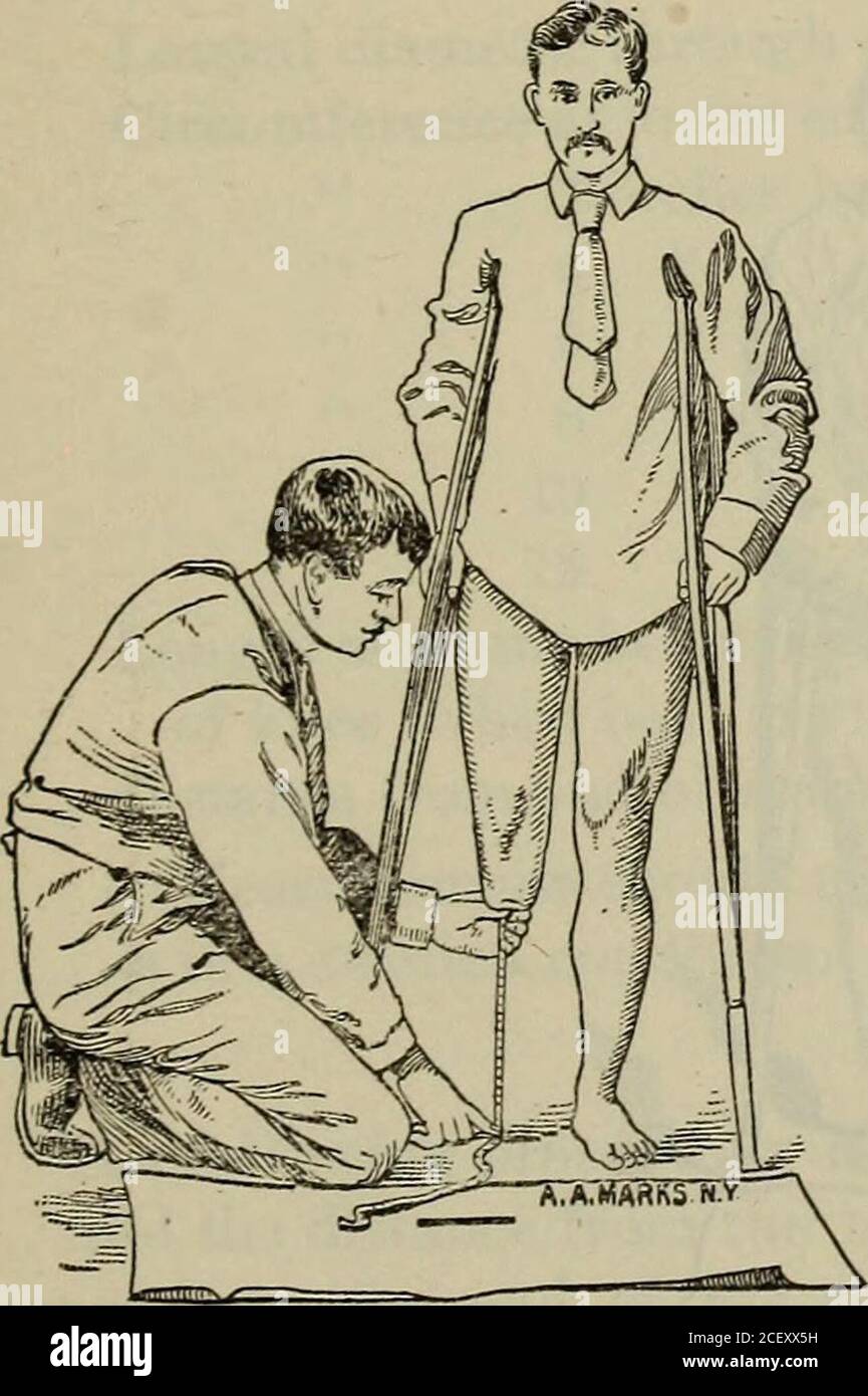 . A treatise on artificial limbs with rubber hands and feet ... No. 876 ...