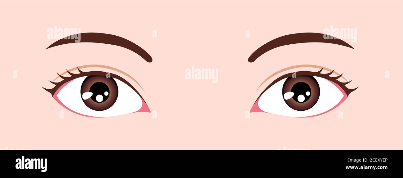 Eye shapes ( eyeball size and position ) vector illustration Stock ...