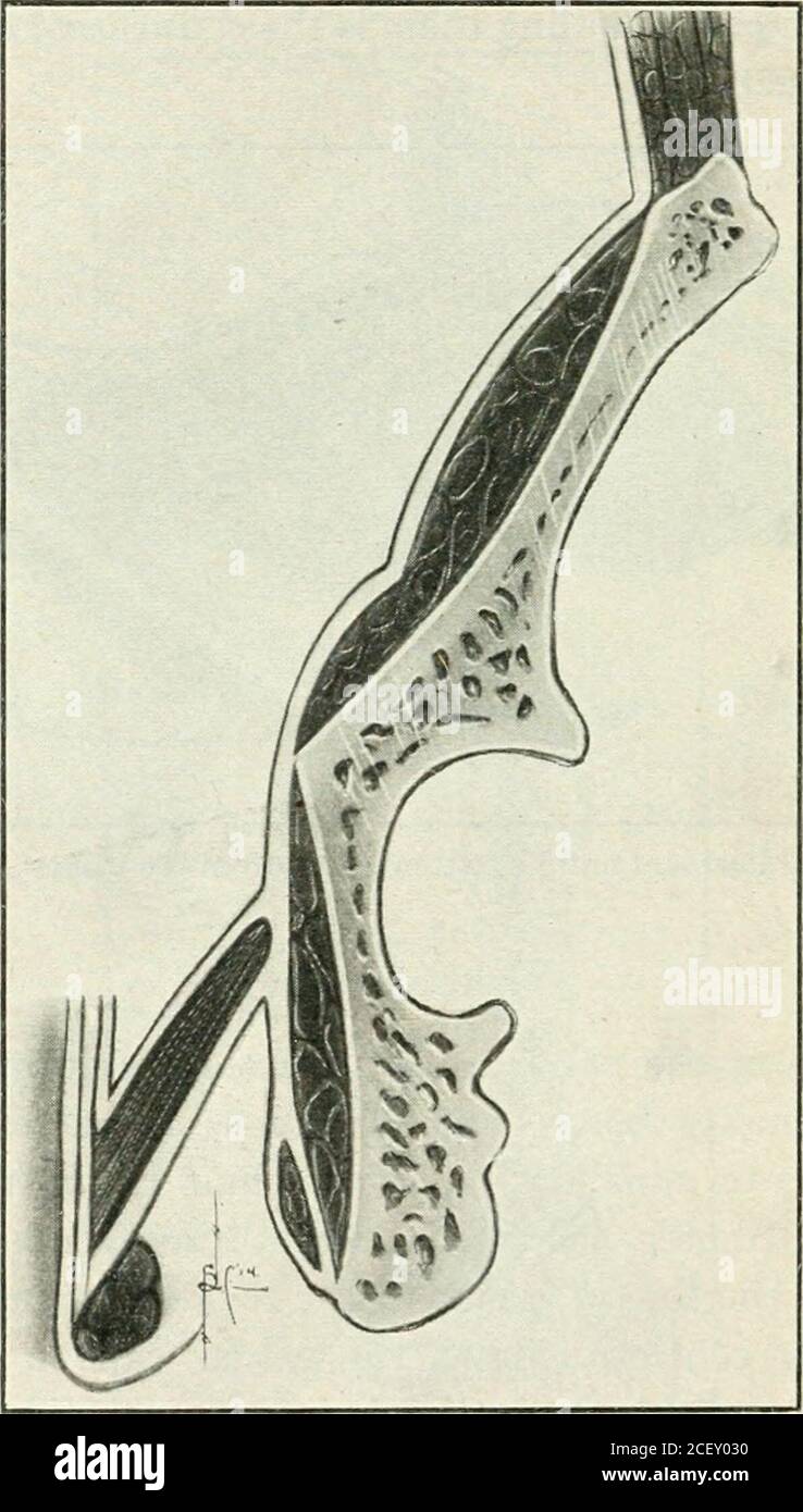 . A manual of gynæcology and pelvic surgery, for students and ...
