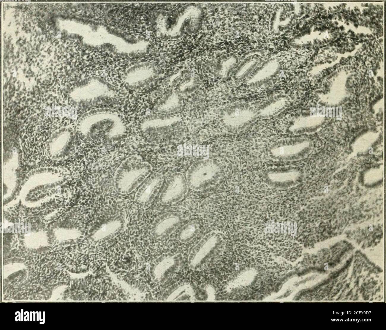 Multiparous hi-res stock photography and images - Alamy