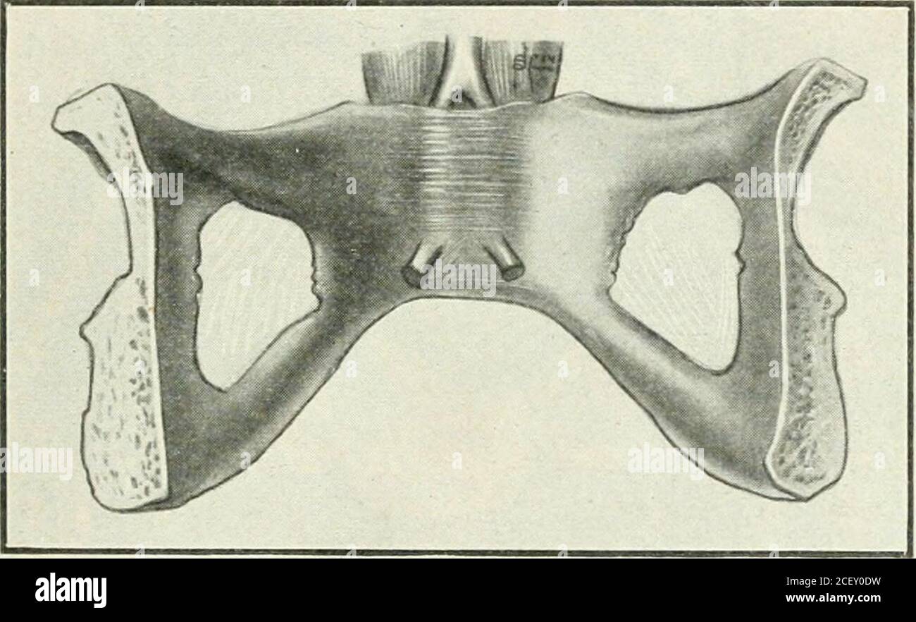 . A manual of gynæcology and pelvic surgery, for students and ...