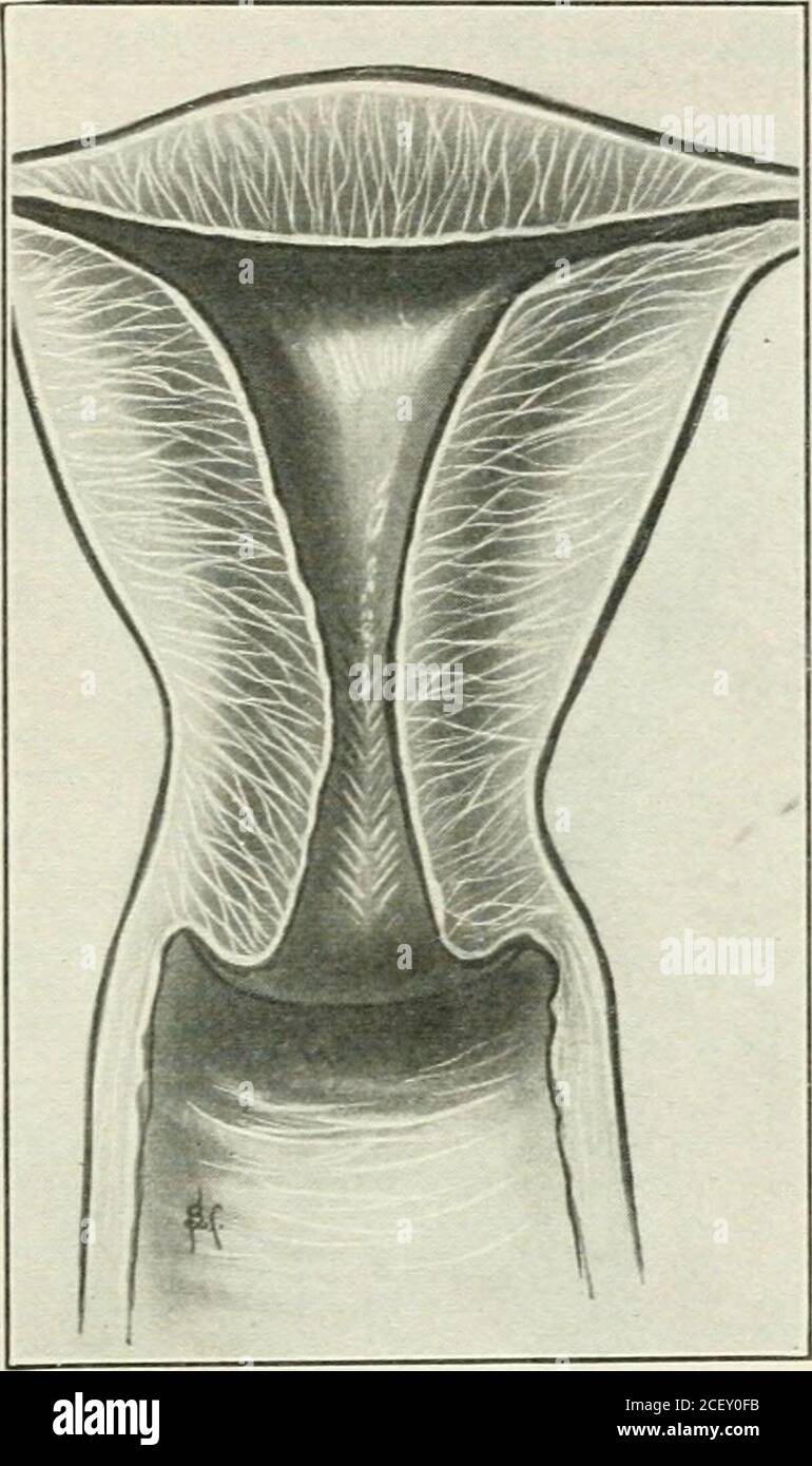 . A manual of gynæcology and pelvic surgery, for students and ...