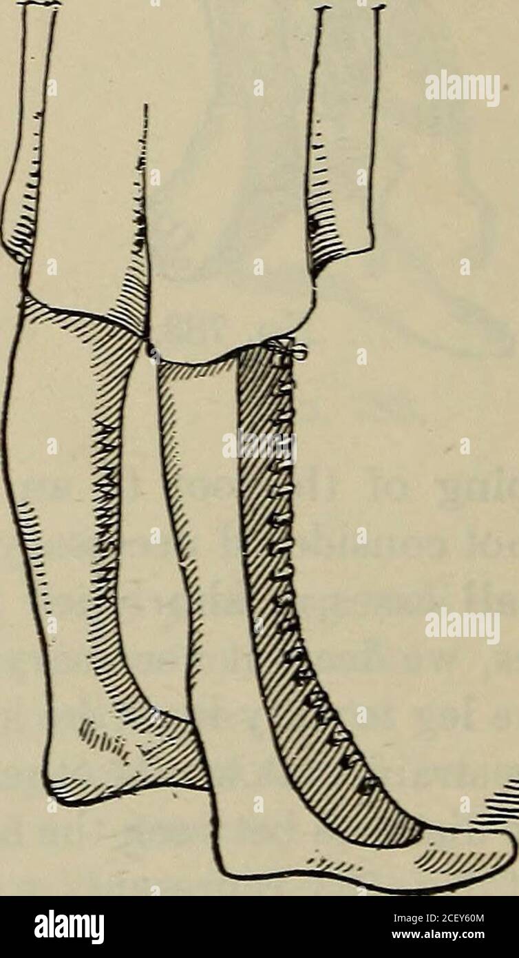 Shortened limbs hi-res stock photography and images - Alamy