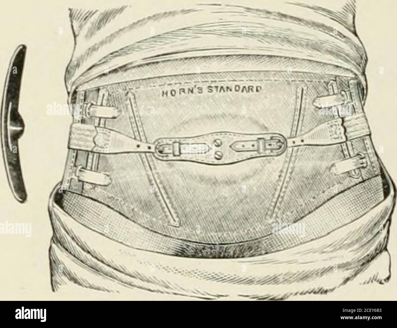 . Abdominal hernia : its diagnosis and treatment. Concave liard-rubber ...