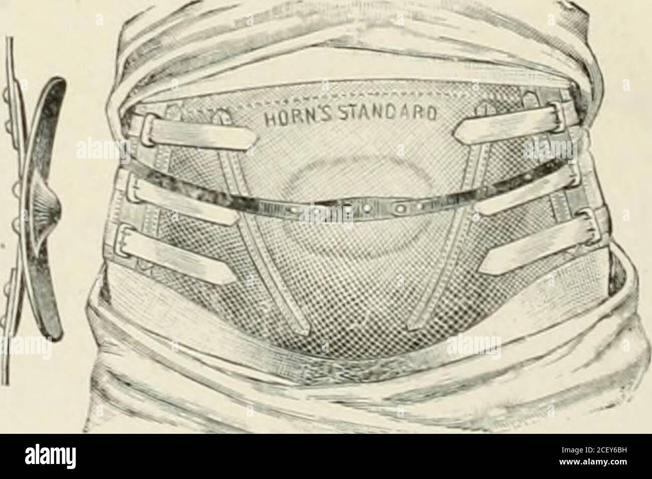 . Abdominal hernia : its diagnosis and treatment. II. Combinalioa belt ...