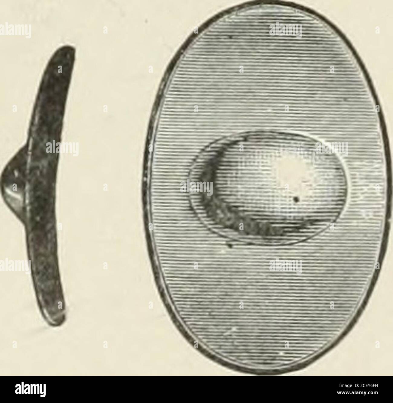 . Abdominal hernia : its diagnosis and treatment. 10. Elastic umbili ...