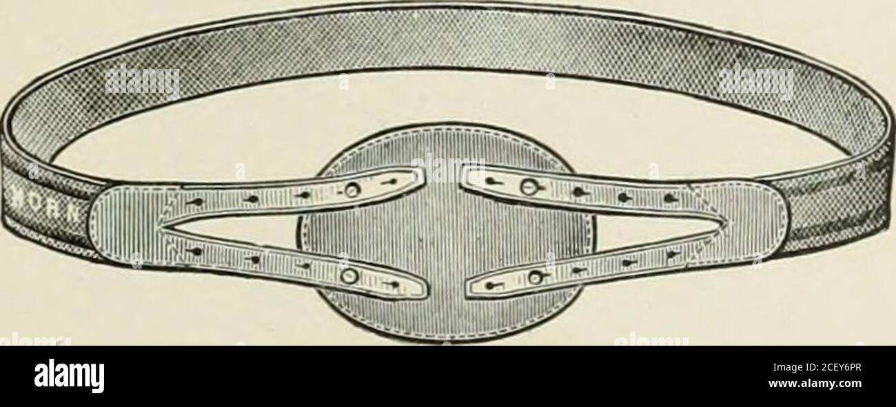 . Abdominal hernia : its diagnosis and treatment. 7. Elastic umbilical ...