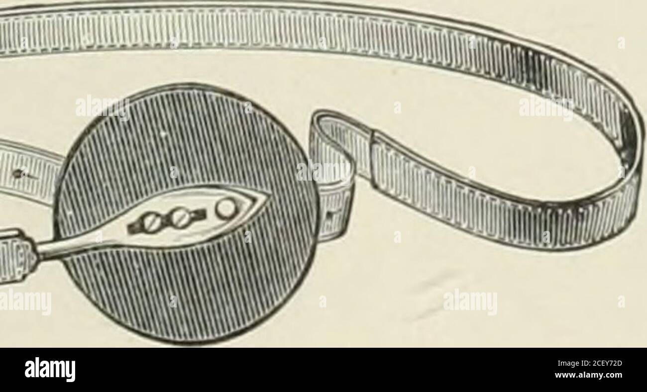 . Abdominal hernia : its diagnosis and treatment. w, V^. 3. Chase ...