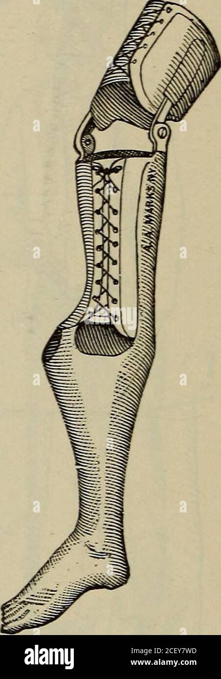 . A treatise on artificial limbs with rubber hands and feet ... No. 754 ...