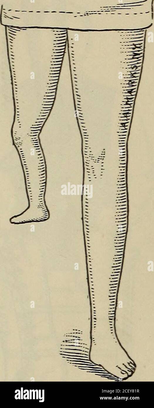 Gunshot wound leg hi-res stock photography and images - Alamy