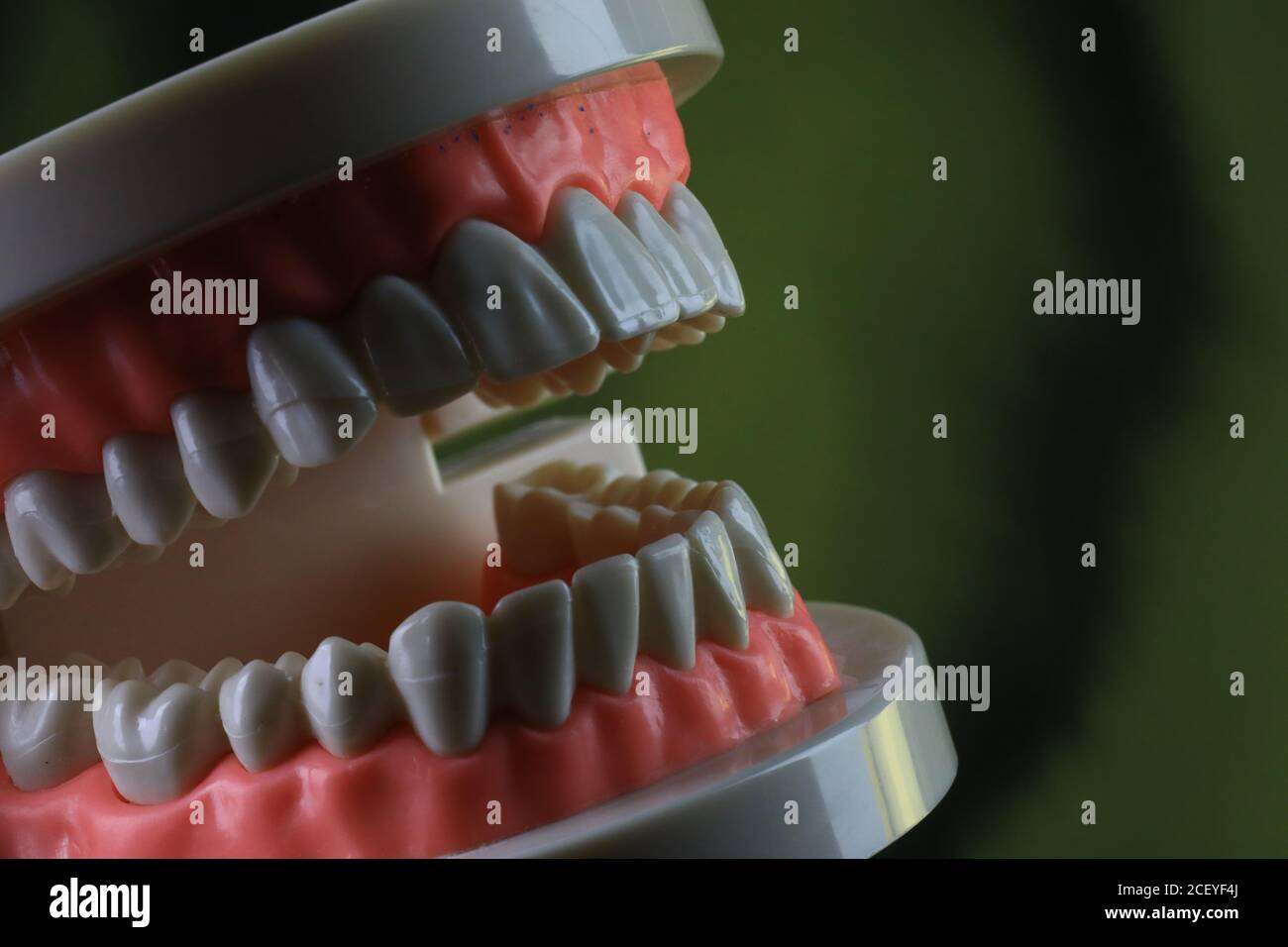 Dental model of human teeth Stock Photo - Alamy