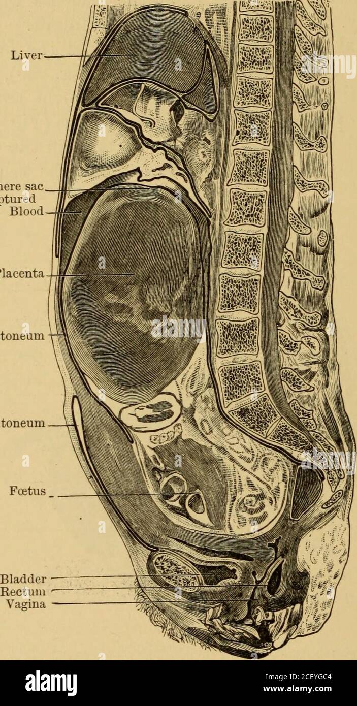 . Diseases of women. A clinical guide to their diagnosis and treatment ...