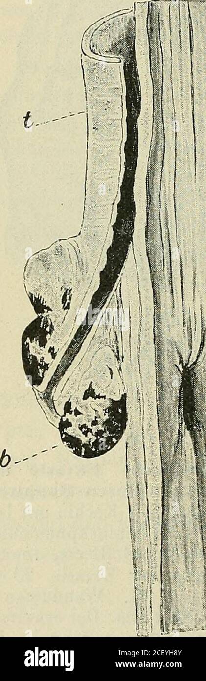 Ausbuchtung hi-res stock photography and images - Alamy