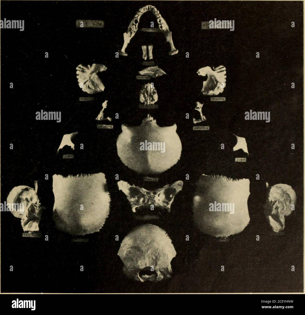 Skull is made up of 22 bones hi-res stock photography and images - Alamy