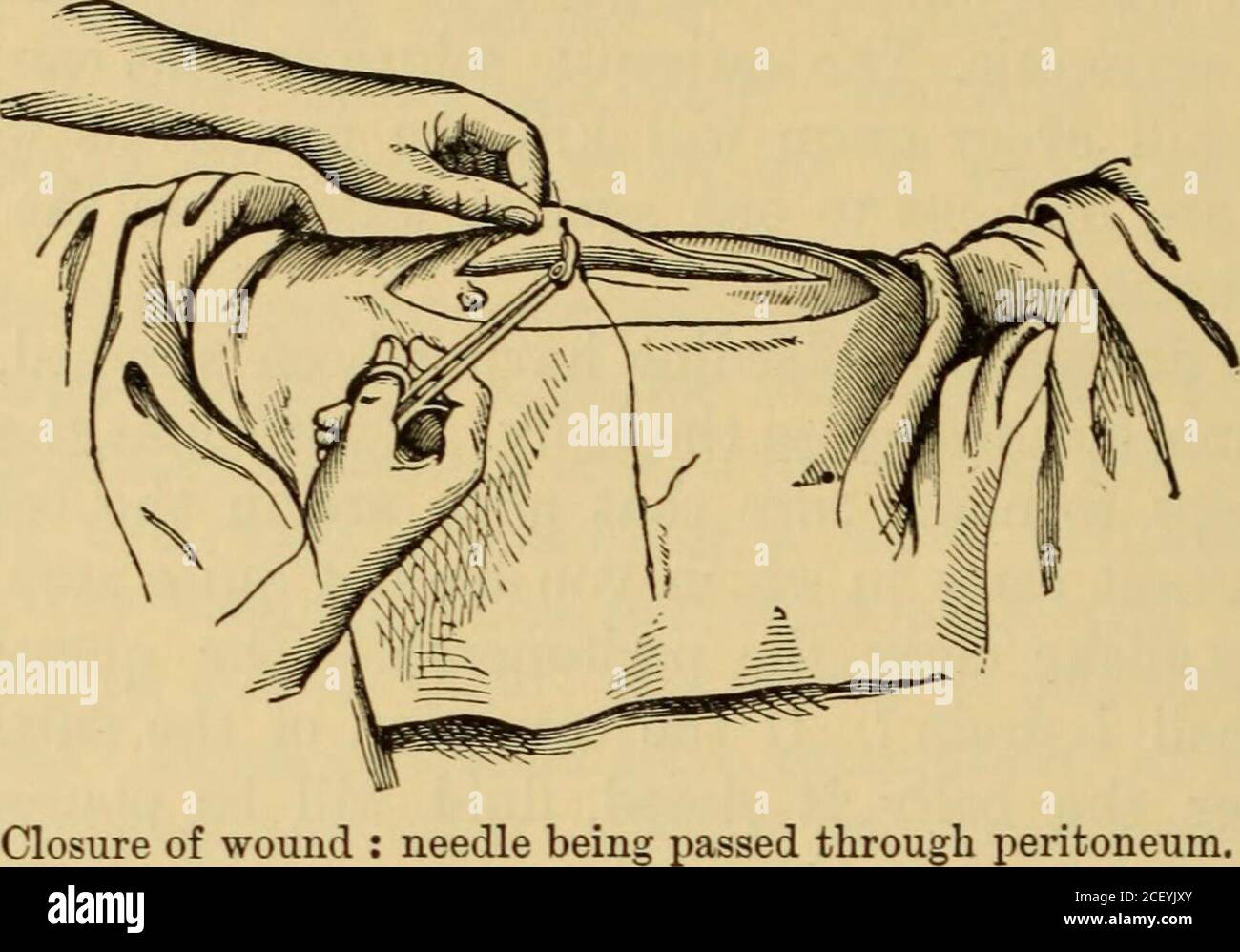 Heals muscles hi-res stock photography and images - Alamy