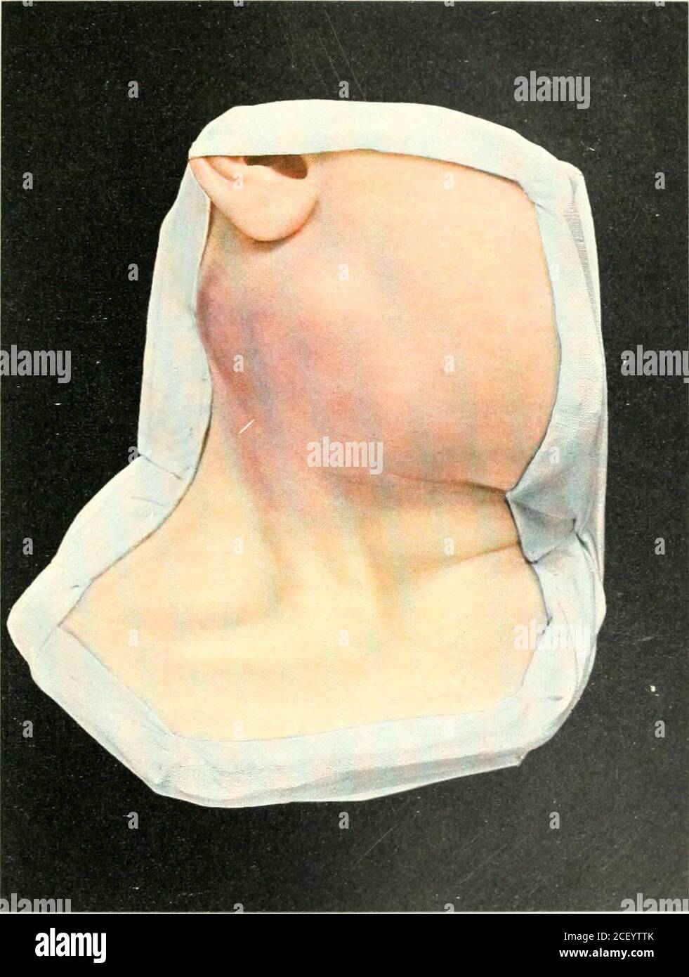 Special Skin Glands High Resolution Stock Photography and Images - Alamy