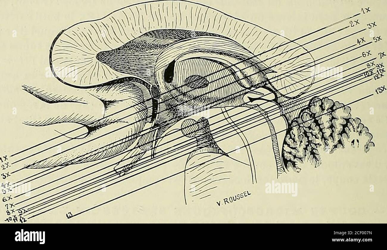 . Anatomie des centres nerveux. o-lenticulaire de la capsule interne ...